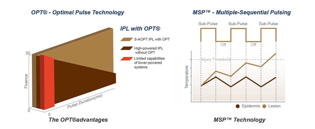 New product IPL filters beauty machine - Beijing Sano laser Development ...
